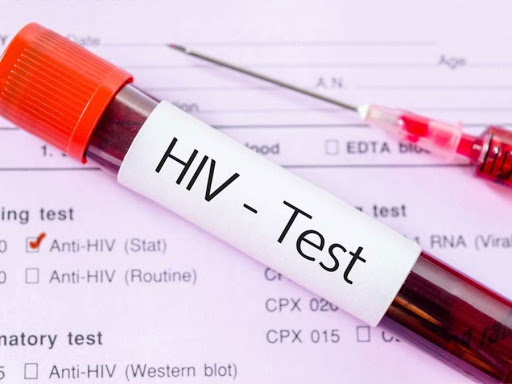 Novo tratamento contra HIV desenvolvido no Brasil cura paciente - TecMundo